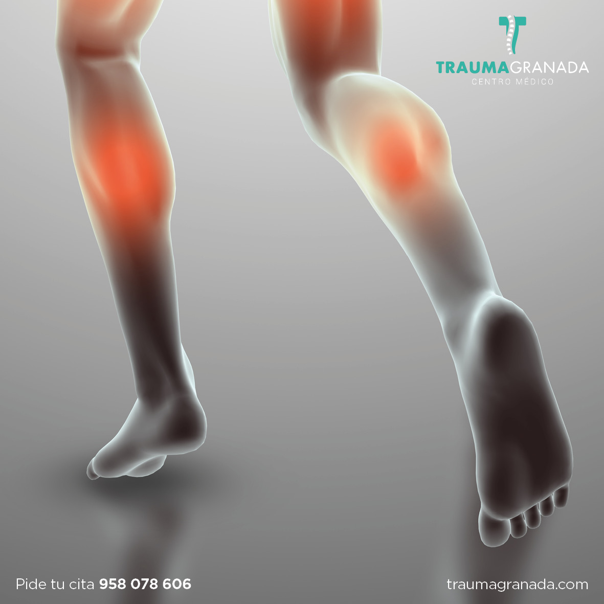 Rotura o desgarro muscular de gemelo - Trauma Granada