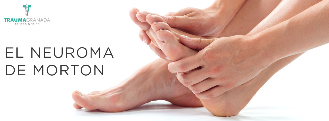 El Neuroma de Morton - Trauma Granada